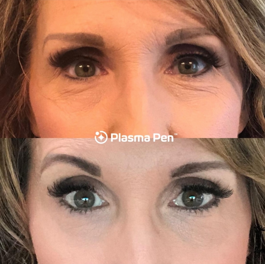 Berdion Aesthetics – Medical Spa – Aesthetics, HGH, Sermorlin, Laser ...